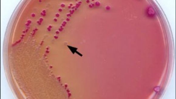 Sorbitol MacConkey Agar | Nazar Tıp Ltd. Şti.