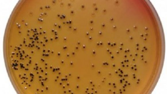 SS Agar (Salmonella Shigella Agar) | Nazar Tıp Ltd. Şti.