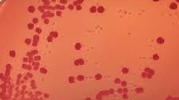 Violet Red Bile Glucose Agar (VRBGA) | Nazar Tıp Ltd. Şti.