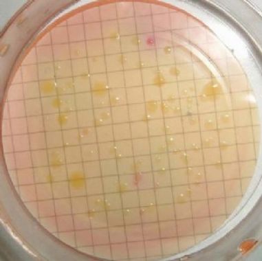 Membrane Lauryl Sulphate Broth | Nazar Tıp Ltd. Şti.