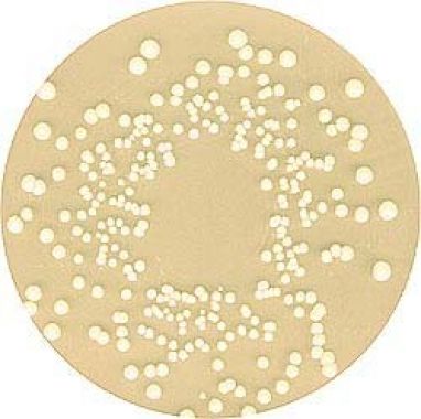 Orange Serum Agar | Nazar Tıp Ltd. Şti.