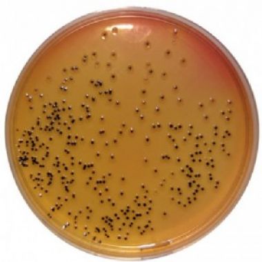 SS Agar (Salmonella Shigella Agar) | Nazar Tıp Ltd. Şti.